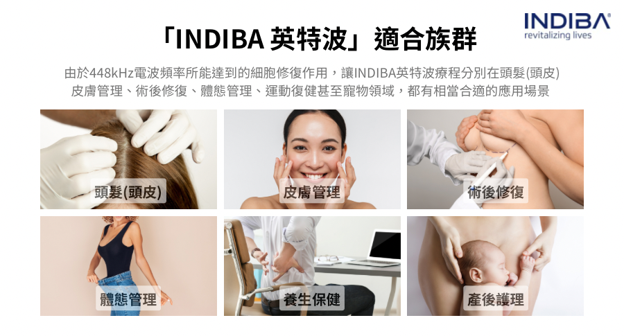 INDIBA 英特波：您需要知道的事 | 醫美圈圈